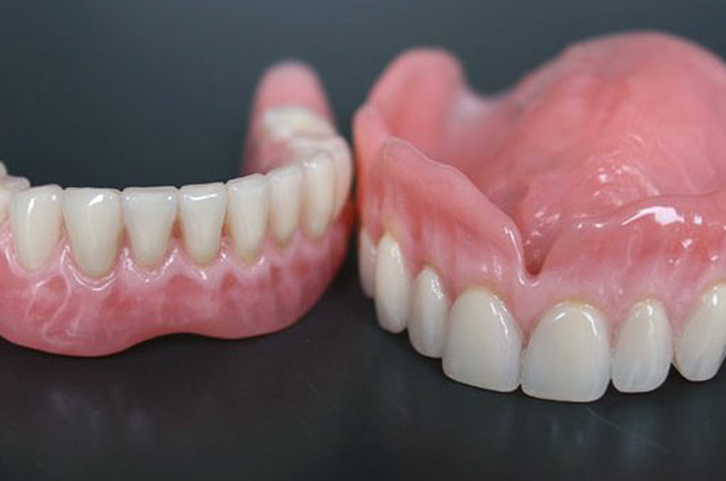 Protesi fissa e dentiera a Cremella | Studio Dentistico Marina Fiocca